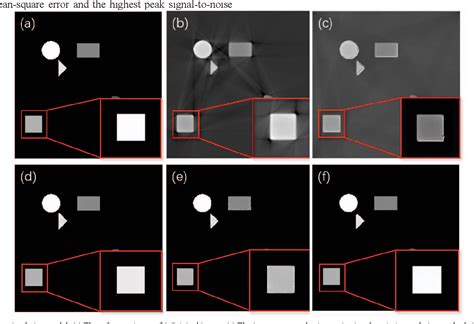 Table 1 From Correction Of The Beam Hardening Artifacts In Ct Images Using Pix2pixgan Network