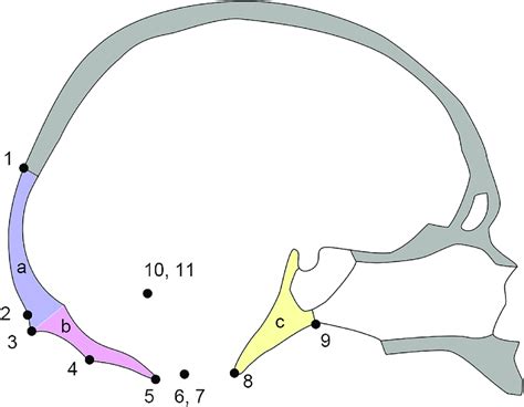 Diagram Of Occipital Landmarks And Occipital Components In Sagittal