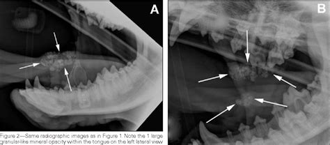 Figure 2 From What Is Your Diagnosis Calcinosis Circumscripta