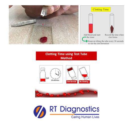 Clotting Time Rt Diagnostics