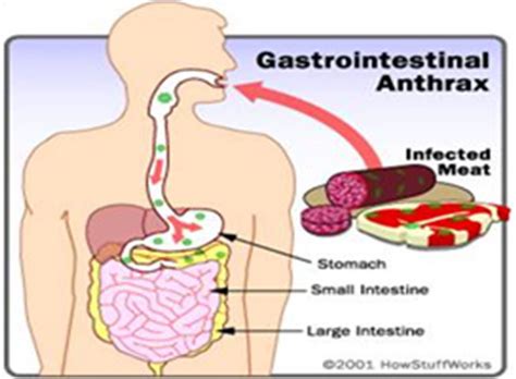 Cutaneous Infection Download Scientific Diagram