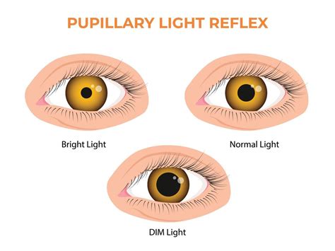 Do Dilated Pupils React To Light At Layla Dickens Blog