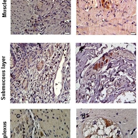 Immunostaining Of Semaphorin 3d In Colon From Controls And Hscr