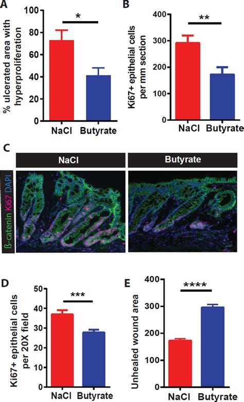 The Colonic Crypt Protects Stem Cells From Microbiota Derived Metabolites Pmc