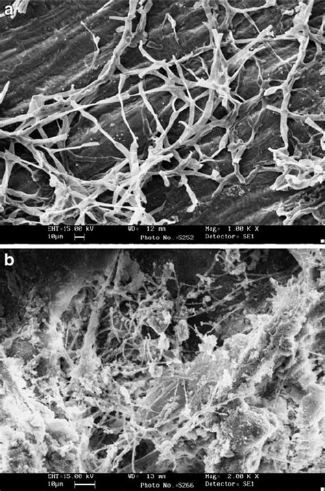 β N Acetylhexosaminidase Production By C Lindemuthianum Atcc 56676 At