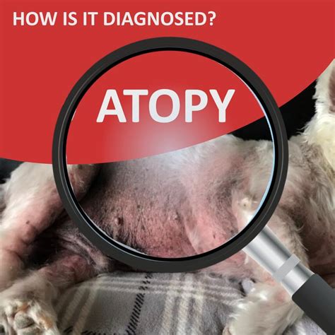 How Is Atopy Diagnosed