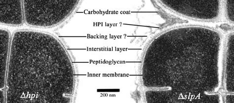 Deinococcus Radiodurans Gram Stain