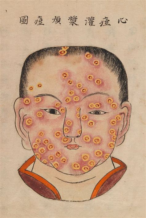 Bizarre Smallpox Illustration From The Japanese Manuscript Ca 1720 Design You Trust — Design