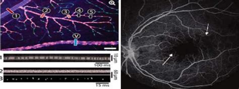A Projection Map Of Retinal Vascular Network B Sem Of Retinal Download Scientific Diagram