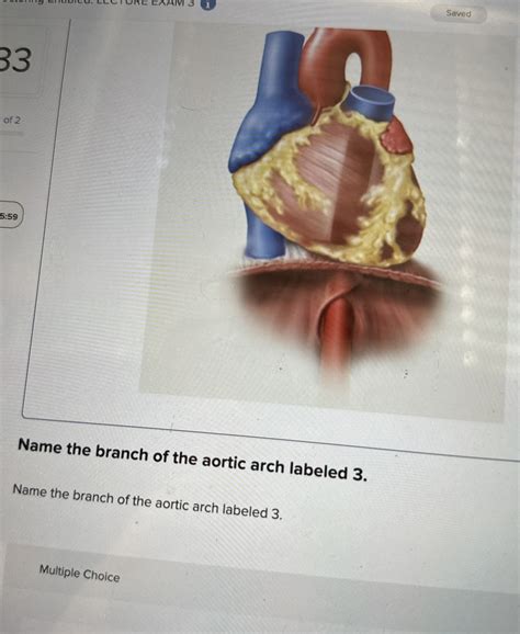 Solved 33of 25 59name The Branch Of The Aortic Arch Labeled