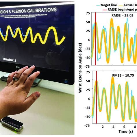 Accuracy Measures Left Photograph Of Subject Performing Hand Opening
