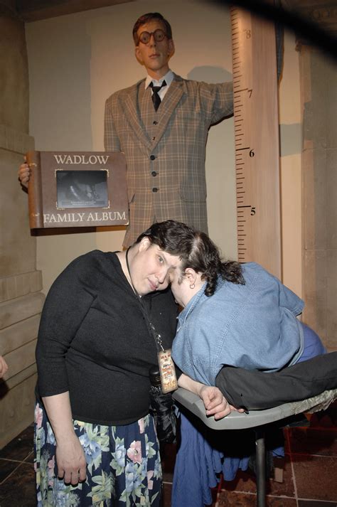 Im A Conjoined Twin But Manage To Have Sex With My Man Heres How We Make It Work Despite My