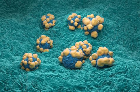 Adenocarcinoma Cells Illustration Stock Image F0406687 Science