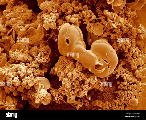 Iron Rust Microscope Or Microscopic Hi Res Stock Photography And Images Alamy