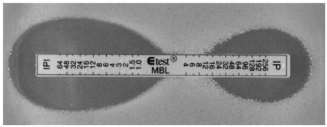 Etest Mbl Strip Tested Against An S Marcescens Strain Expressing The Download Scientific