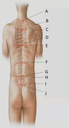 Routine Spine Workbook Flashcards Quizlet