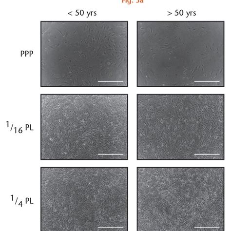 Pdgf Binding And Signalling Pathways A Pdgf Pdgfr Interactions