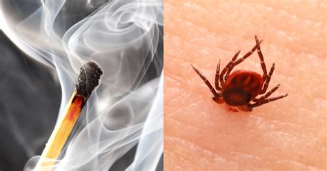 აიღეთ ასანთი ცეცხლი წაუკიდეთ შეუბერეთ აი როგორ უნდა მოიშოროთ ტკიპა