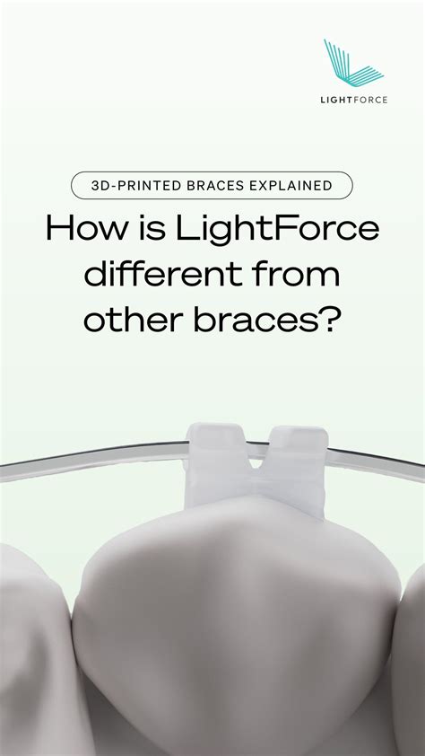 Lightforce 3d Printed Braces Picture This You Go To The