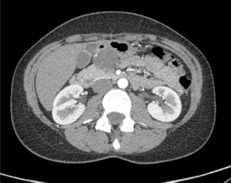 Post Contrast Ct Arterial Phase Download Scientific Diagram