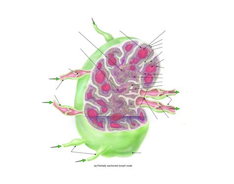 Partially Sectioned Lymph Node Quiz
