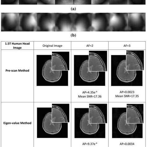 Steps Involved In Estimating The Receiver Coil Sensitivity Maps Using