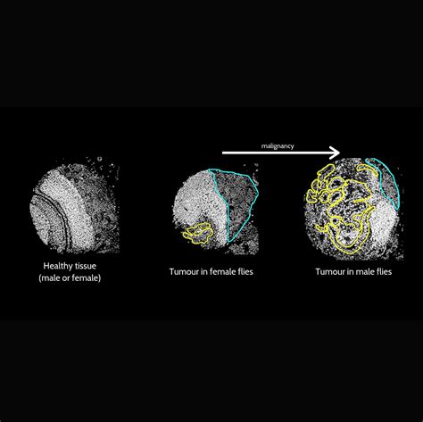 Researchers Identify Genes Related To Sex Related Differences In