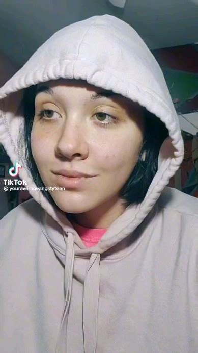 Braces Lovers 🥰 Bracesbitches • Instagram Photos And Videos