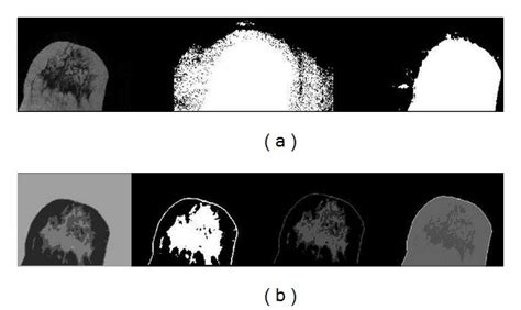 from left to right a original mri slice pixels with gray value