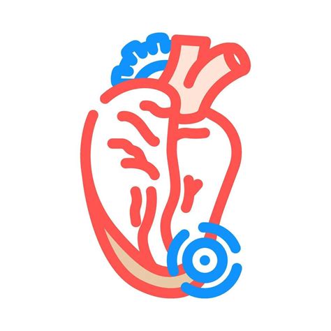 Pericarditis Cardiology Disease Color Icon Illustration 58396229 Vector