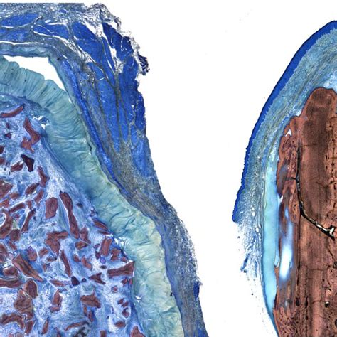 Histologic Images At 4‐ And 24‐week Follow‐up Of A Created Alveolar