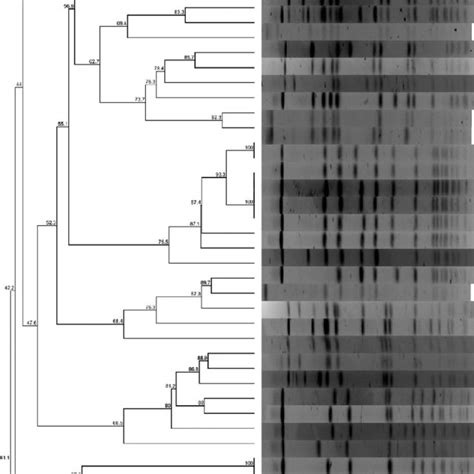 Genetic Similarity Of Staphylococcus Aureus Isolated From Tonsils Of Download Scientific