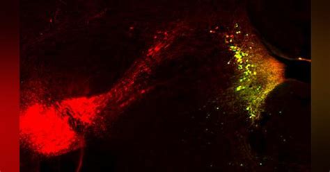 Optogenetics Helps Show What Happens In Brain Cells During Fear Memory Formation Laser Focus World