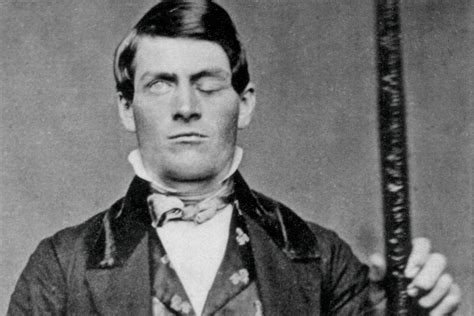 Phineas Gage Die Geschichte Eines Neuro Mythos Psychologie Heute
