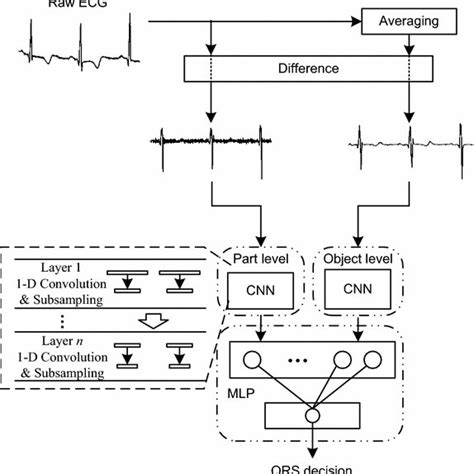 Overview Of The Proposed Qrs Complex Detection Method Download