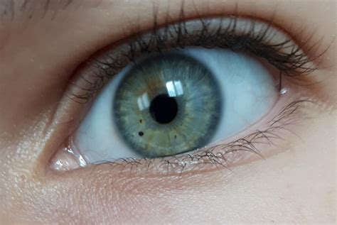 Blue Green Eyes Heterochromia