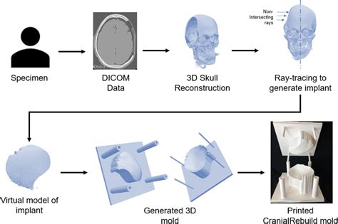 Workflow Of Cranialrebuild Algorithm After The Input Of Dicom Data