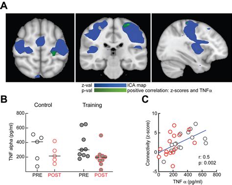 Correlation Between Tnfα And Connectivity In The Sensorimotor Network Download Scientific
