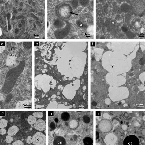 Transmission Electron Micrographs Of Mitochondria Endoplasmic Download Scientific Diagram
