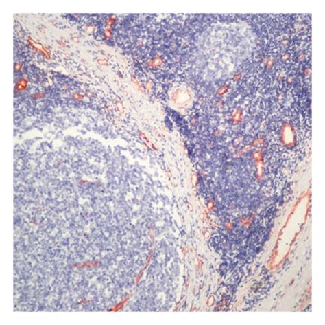 Factor Viii Related Antigen Von Willebrand Factor Ab 2 Mouse Monoclonal