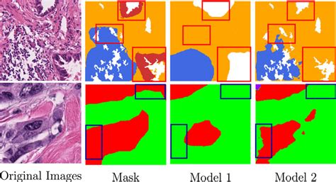 The Challenges Of Tumor Tissue Segmentation In Pathological Images Download Scientific Diagram