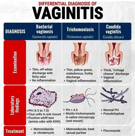 Vaginitis Definition Vaginitis Is Inflammation Or Infection Of The