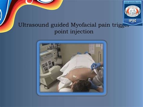 Trigger Point Injection