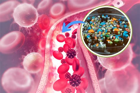 Microplastics In Our Blood A Growing Threat To Brain Health Greenme