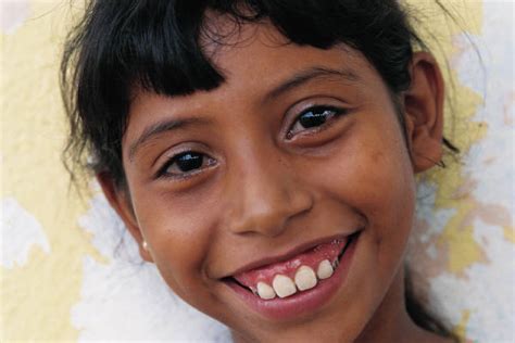 Lisping Quand S Et Z Sont Difficiles à Dire Iwofr