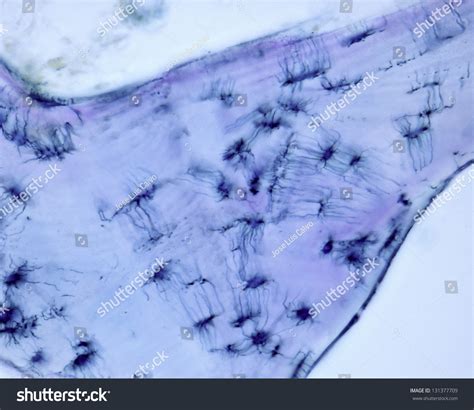 Osteocyte Microscope