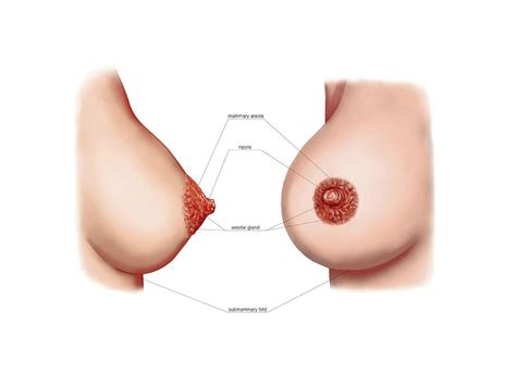 Postpartum Breasts Photograph By Asklepios Medical Atlas Pixels