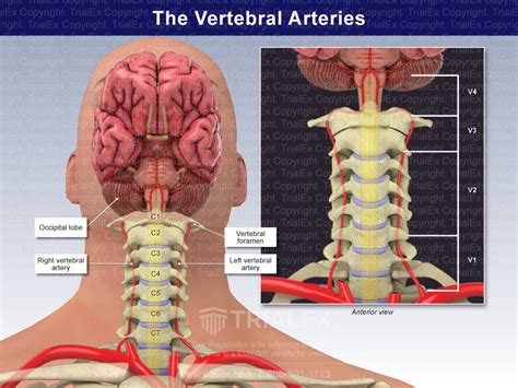 The Vertebral Arteries Trialquest Inc