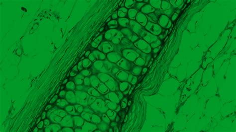 Transcript Role Of Complement In Axonal Integrity Medthority