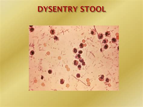 Ppt Salmonella And Shigella Powerpoint Presentation Free Download Id